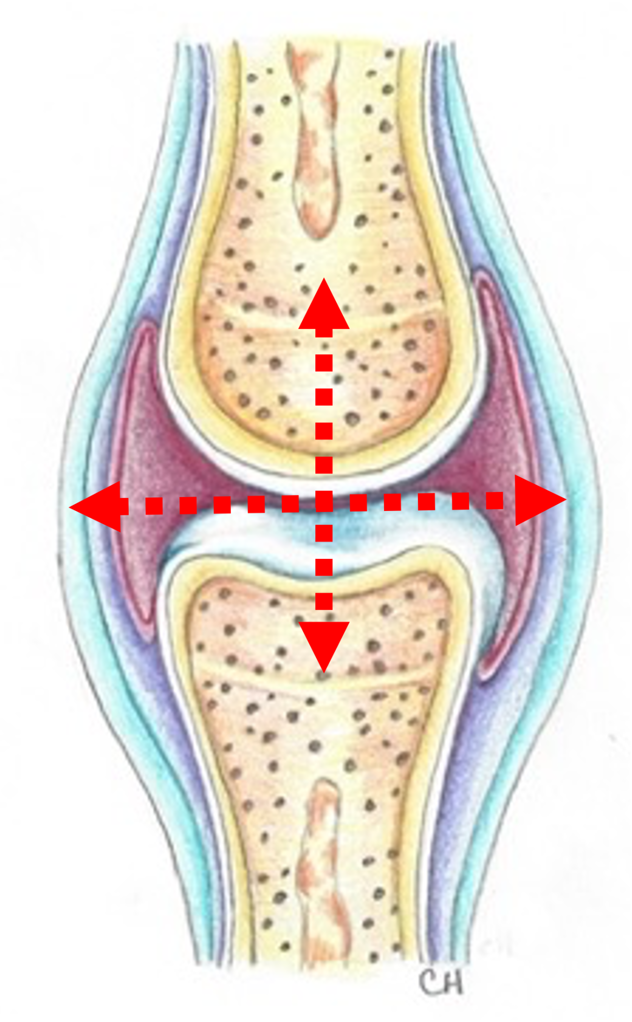 The Importance of Isometrics for the Joint Replacement Client, Part 2 ...